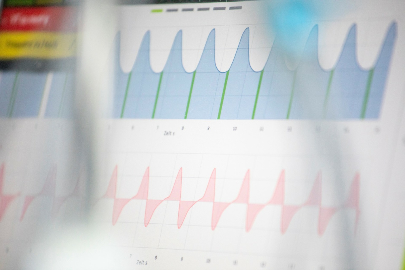Klinikbereiche - Klinik für Kardiologie und Angiologie