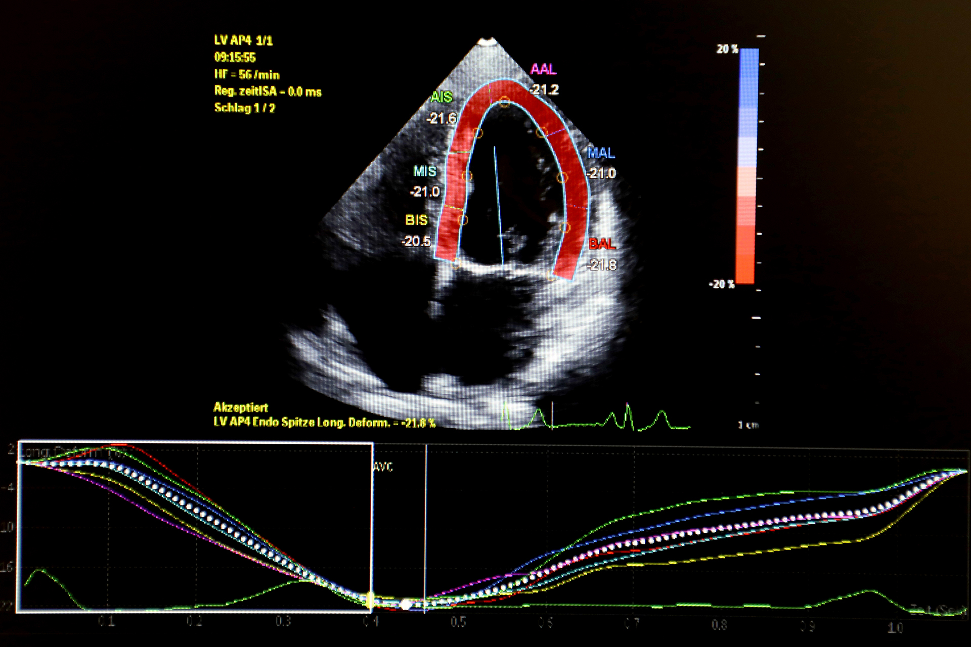 Immune checkpoint signalling in acute myocardial infarction - Klinik ...